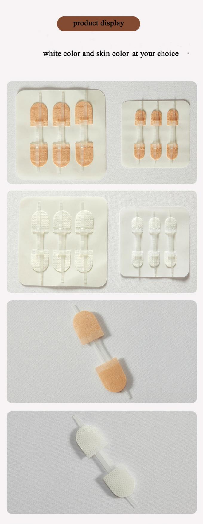 Non Invasive Zip Stitch Suture Wound Closure Device Skin Closure Non ...