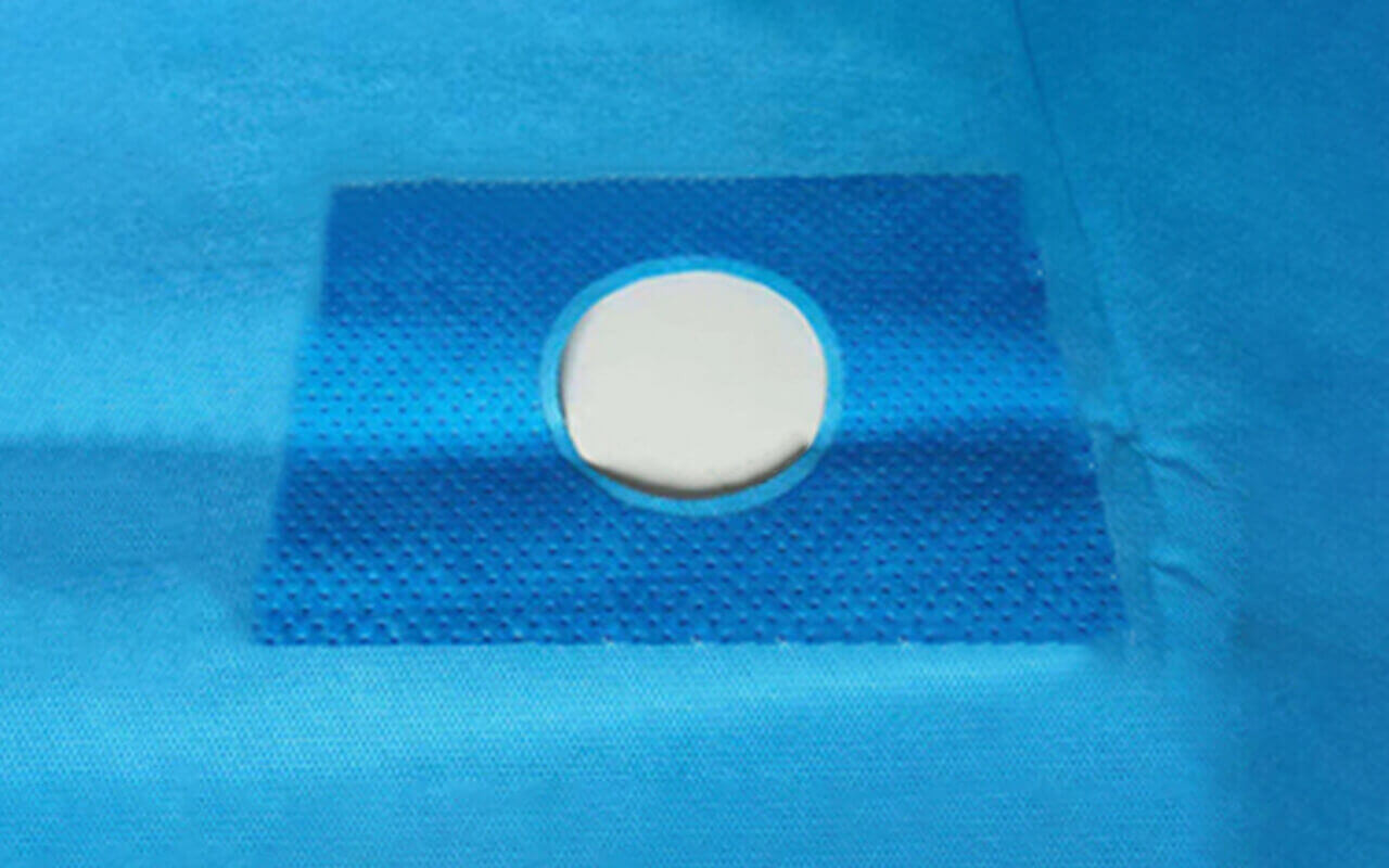 SMS Coated Sterile Aperture Drape Medical Disposable Surgical With Hole
