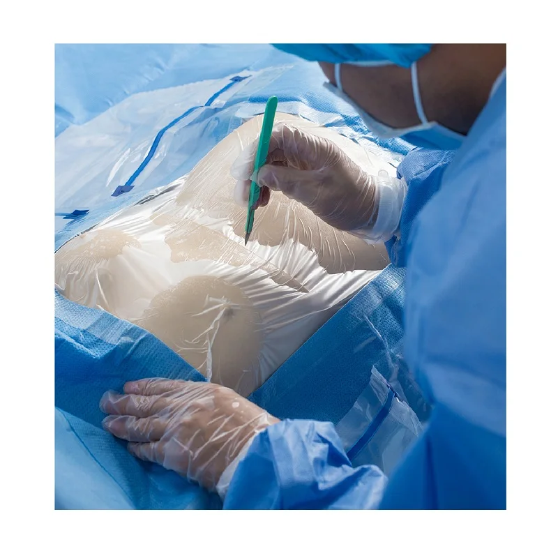 Class I Instrument Classification Caesarean Drape with Liquid Pouch ...